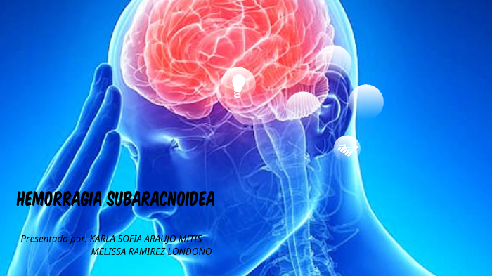 HEMORRAGIA SUBARACNOIDEA by CAMILA ARAUJO on Prezi