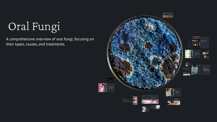 Understanding Oral Fungi: Types, Causes, and Treatments by gaber salah ...