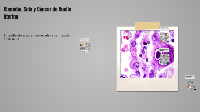 Clamidia, Sida y Cáncer de Cuello Uterino by Antonia Castro on Prezi