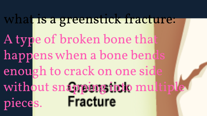 Greenstick fracture by Joslyn Lineberger on Prezi