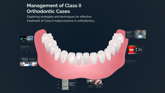 Management of Class II Orthodontic Cases by Abeer Jf on Prezi