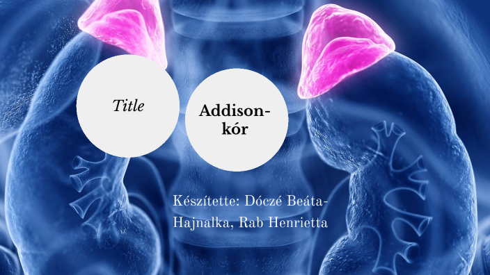 Addison kór by Beáta Dóczé on Prezi