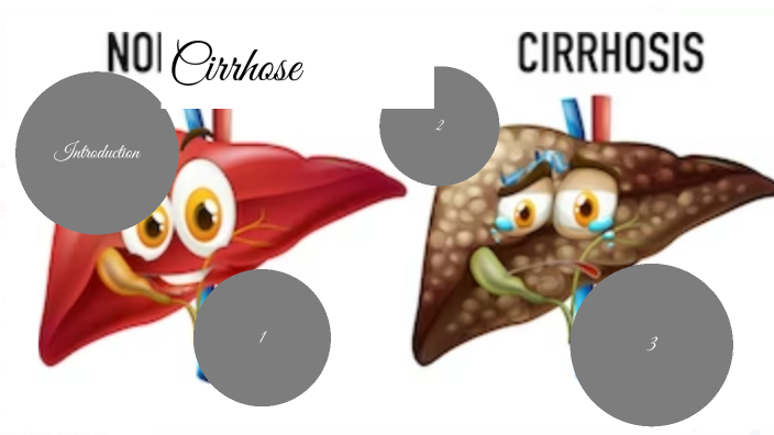 cirrhose by Salma Saoudi on Prezi