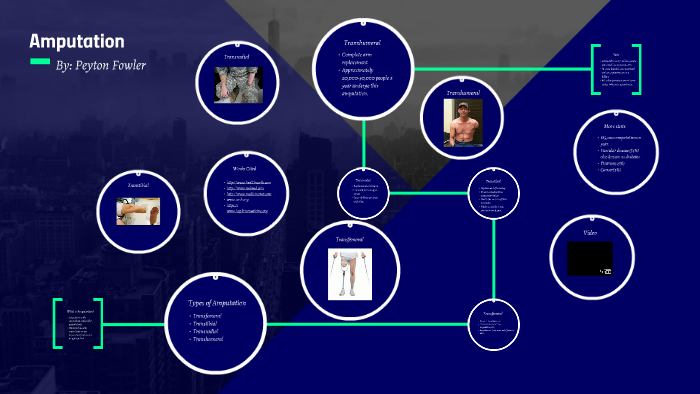 Amputation by peyton fowler on Prezi