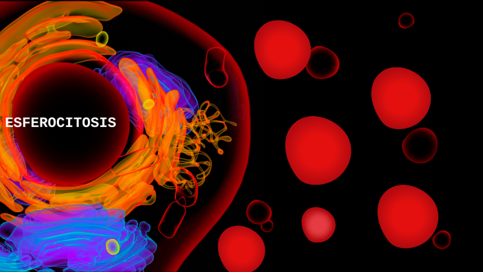 Esferocitosis by Ana Lyz Londero Lloubell on Prezi