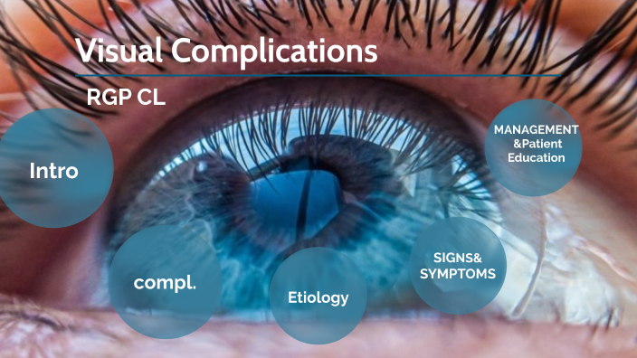 RGP contact lenses by Aseel Daraghmeh on Prezi