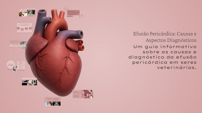 Efusão Pericárdica: Causas e Aspectos Diagnósticos by Sky Moon on Prezi