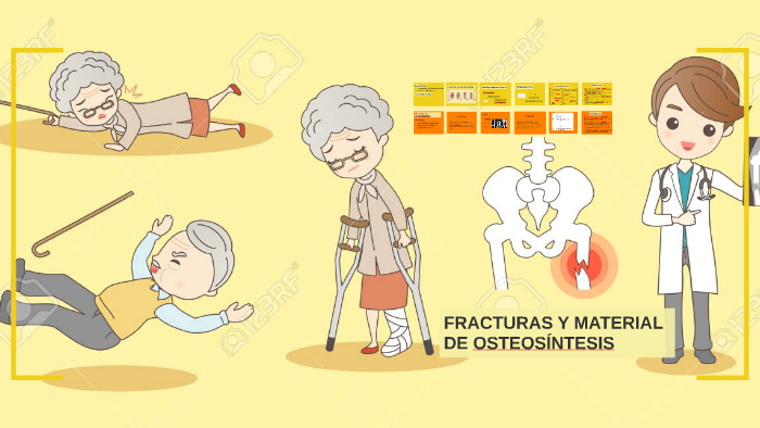 FRACTURAS Y MATERIAL DE OSTEOSÍNTESIS by Mariana Gomez on Prezi