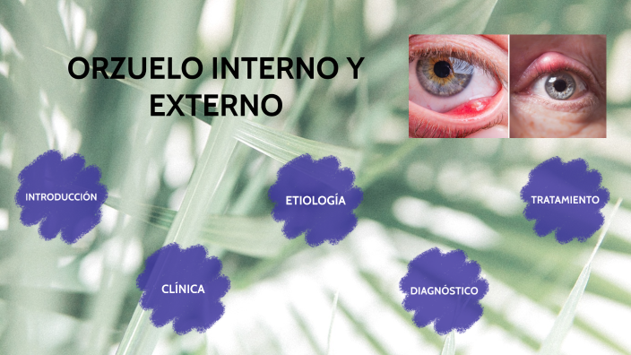 ORZUELO INTERNO Y EXTERNO by Estefanía Alcázar on Prezi