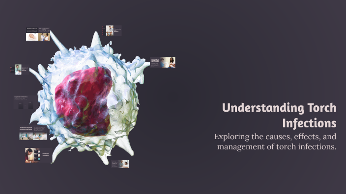 Understanding Torch Infections by wael hashem on Prezi