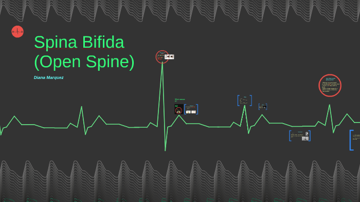 Spina Bifida (Open Spine) by Diana Marquez on Prezi