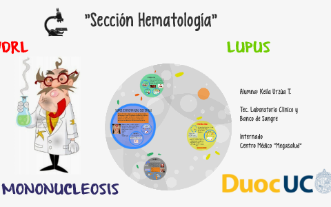 Mononucleosis VDRL y Lupus by Keila Urzúa on Prezi