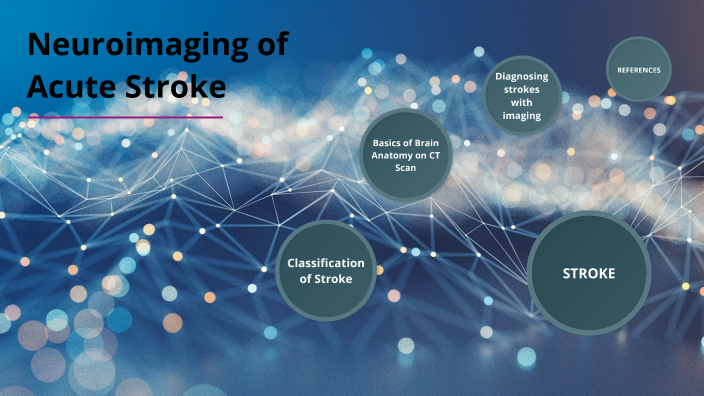 Diagnosing Strokes With Imaging Ct Mri Cta By Tá Tã On Prezi