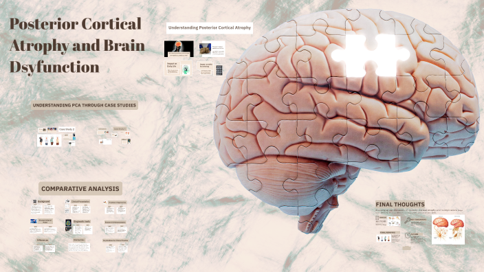 Understanding Posterior Cortical Atrophy and Brain Damage by Khushi ...