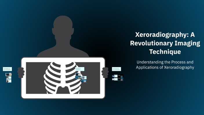 Xeroradiography: A Revolutionary Imaging Technique by faez zirak on Prezi
