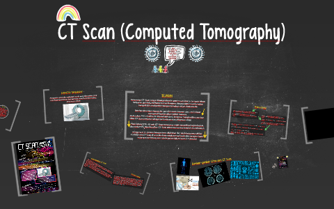 CT Scan (Computed Tomography) by Claudia Hidayat on Prezi