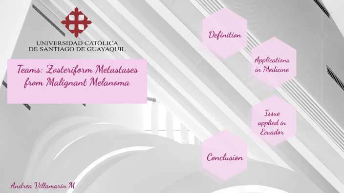 zosteriform metastases from malignant melanoma by Andrea Villamarin Murillo