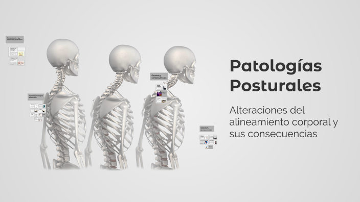 Patologías Posturales by hi aimara on Prezi