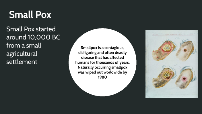 Presentation about Small Pox by Cooper Ruchaber (07) on Prezi