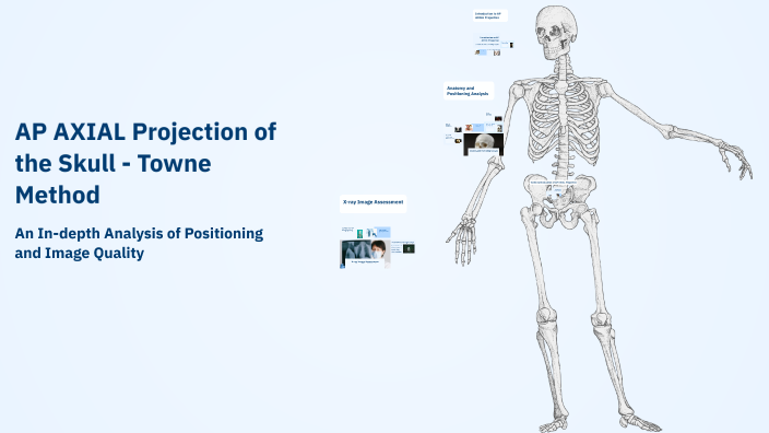 AP AXIAL Projection of the Skull - Towne Method by Trisha Iqbal on Prezi