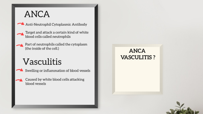 ANCA VASCULITIS by on Prezi