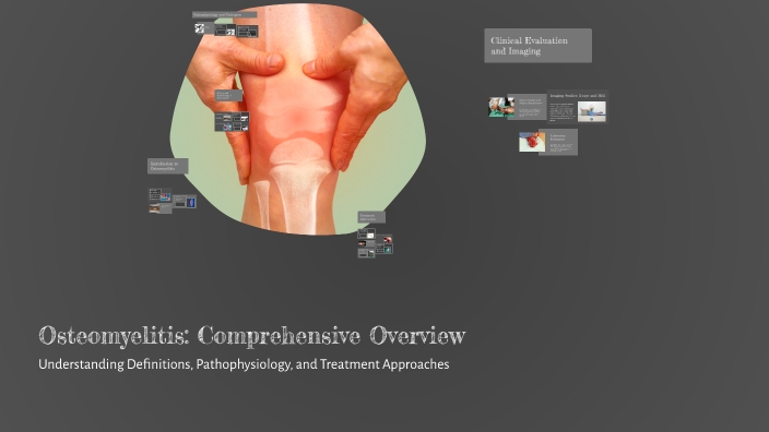 Osteomyelitis: Comprehensive Overview by ggg hhh on Prezi