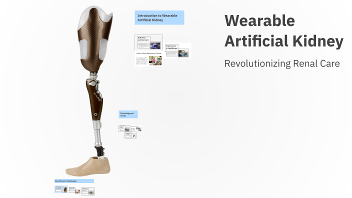 Wearable Artificial Kidney by Smijo 423711 on Prezi