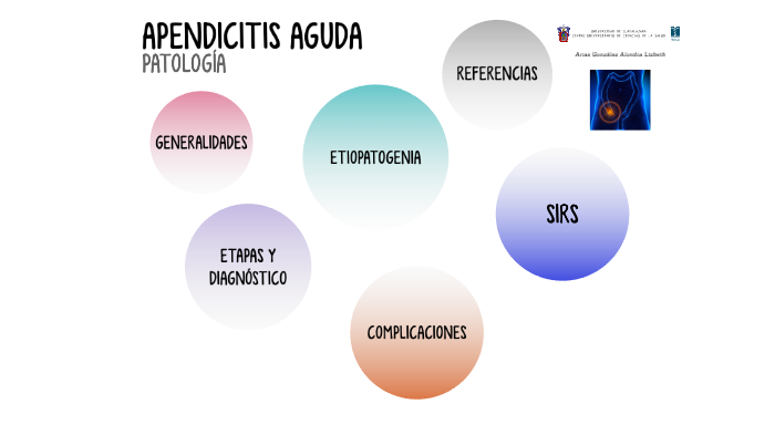 Apendicitis by Alondra Arias González on Prezi