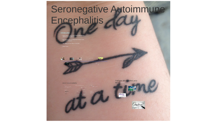 Seronegative Autoimmune Encephalitis by Abigail Stubbs on Prezi