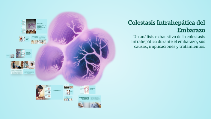 Colestasis Intrahepática del Embarazo by carlos ruiz on Prezi