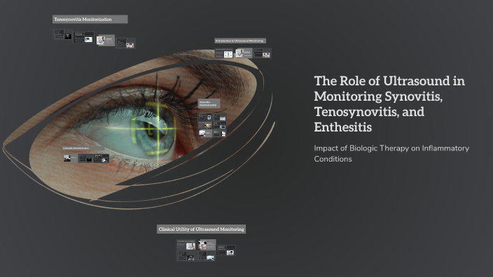 The Role of Ultrasound in Monitoring Synovitis, Tenosynovitis, and ...