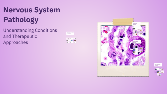 Nervous System Pathology by on Prezi