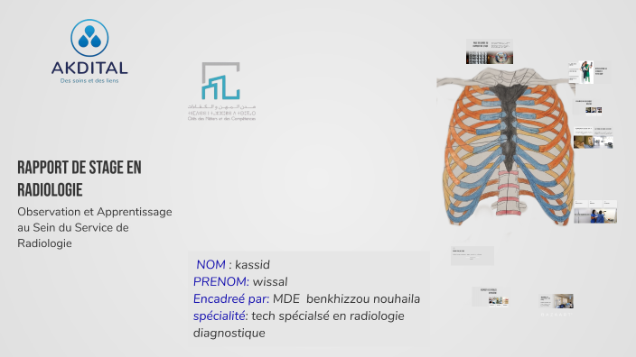 Rapport de Stage en Radiologie by wiss Kass on Prezi