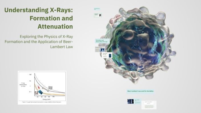 Understanding X-Rays: Formation and Attenuation by Sara Albastaki on Prezi