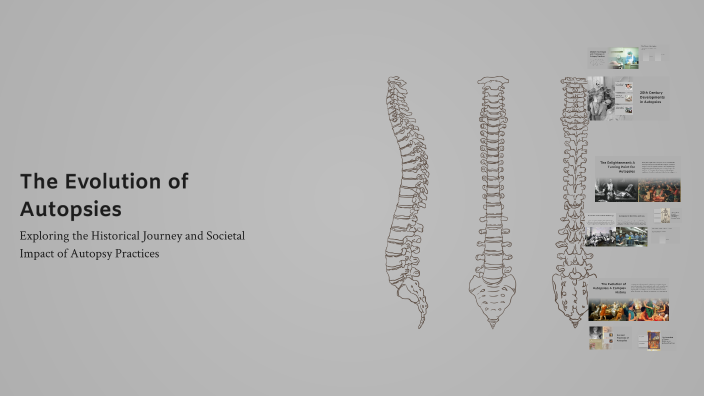 The Evolution of Autopsies by Claire Bianculli on Prezi
