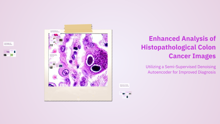 Enhanced Analysis of Histopathological Colon Cancer Images by Leen Moh ...