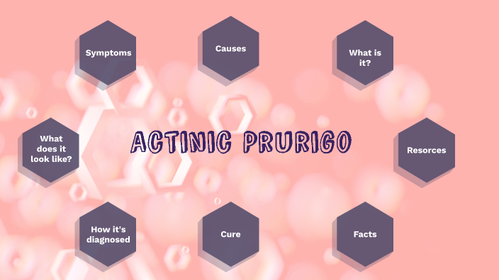 Actinic Prurigo by Kendall Coulter on Prezi