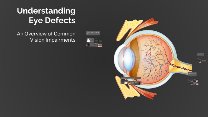 Understanding Eye Defects by sarha rossi on Prezi