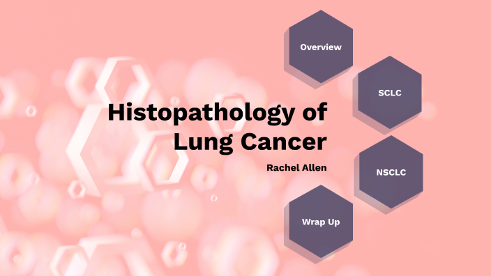 Histopathology of Lung Cancer - 1/25/23 by Rachel Allen on Prezi