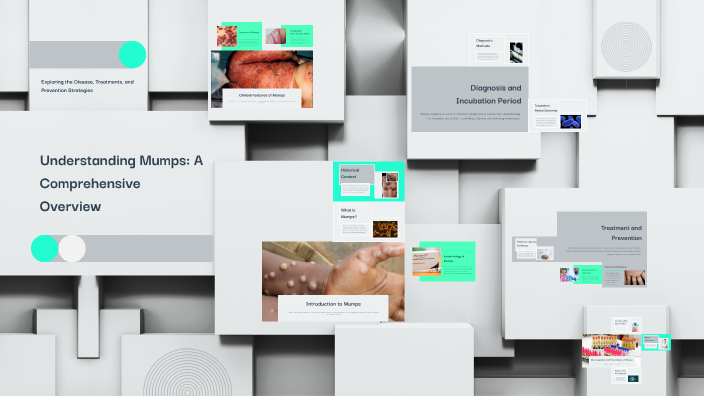Understanding Mumps: A Comprehensive Overview by Jasmine Johnson on Prezi