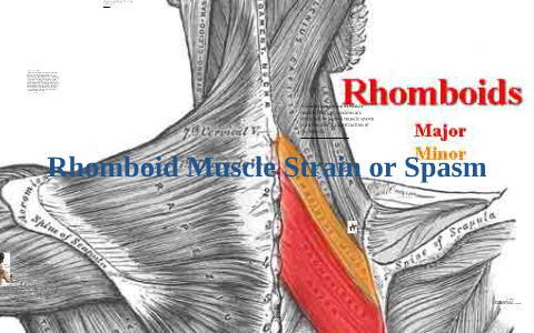 Rhomboid Muscle Strain Or Spasm by molly trujillo on Prezi