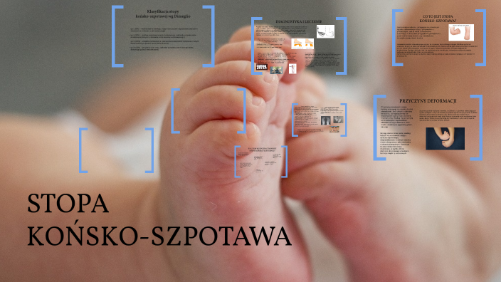 STOPA KOŃSKO-SZPOTAWA by Maria Pospieszna on Prezi