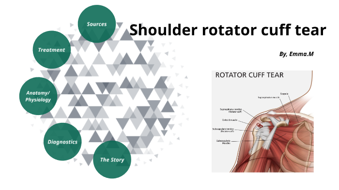 Shoulder rotator cuff tear by Emma Melnyk on Prezi