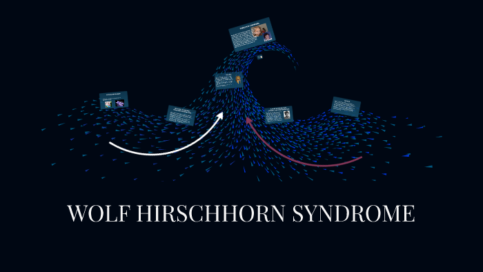 WOLF HIRSCHHORN SYNDROME by Ana Fusaro on Prezi