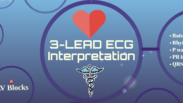 3-LEAD ECG Interpretation by Matthew Hamson on Prezi