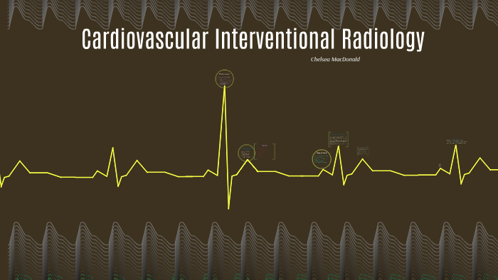 Cardiovascular Intervention by Chelsea MacDonald on Prezi