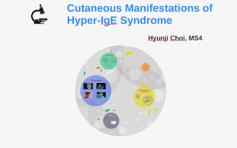 Cutaneous manifestations of Hyper IgE Syndrome by Hyunji Choi on Prezi
