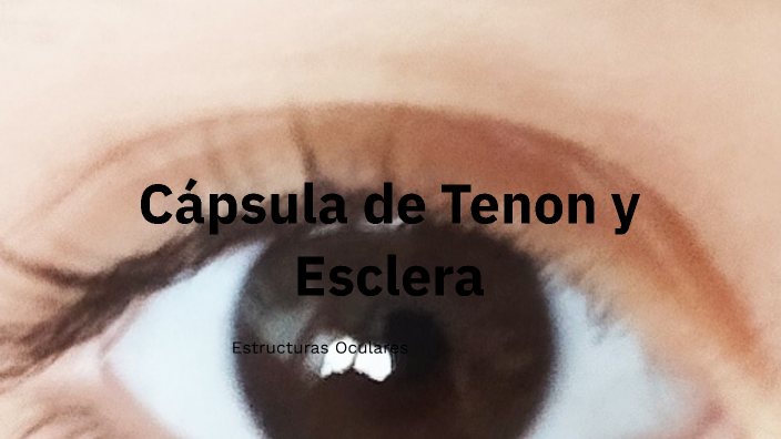 Cápsula de Tenon y E by Yudinelis Reyes on Prezi