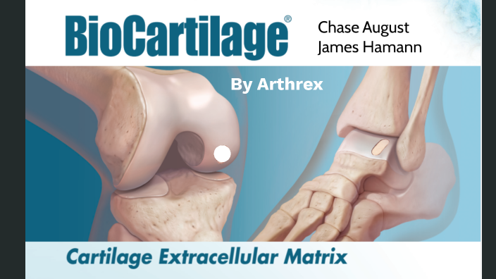 BioCartilage Arthrex by James Hamann on Prezi