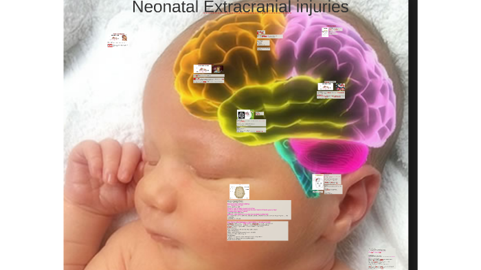 Neonatal Extracranial Injuries by Feroza Patel on Prezi